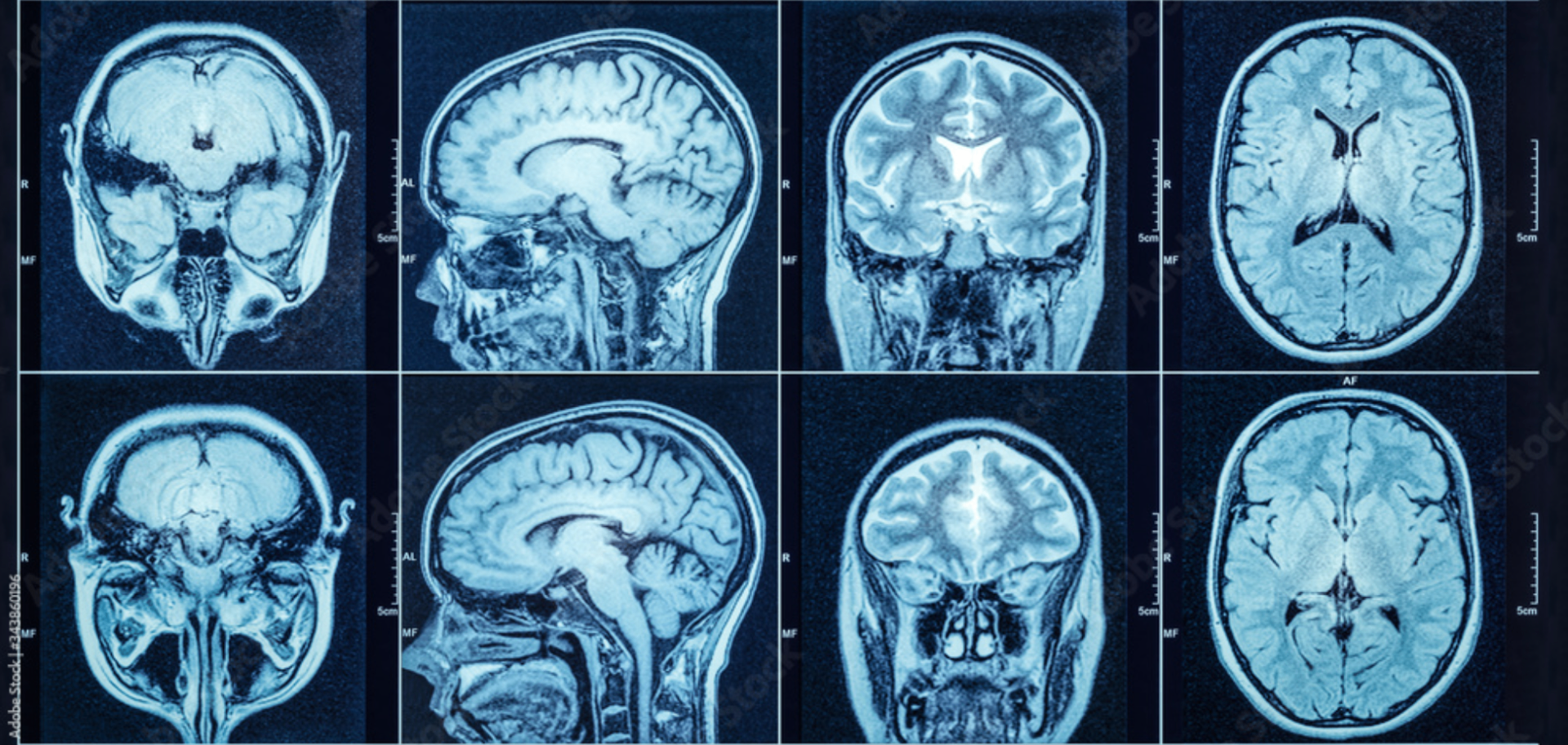 Privat MR, CT & Ultraljud - Boka Online | 20+ Kliniker i Sverige ...